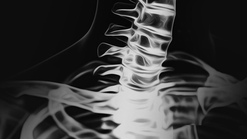 Conditions treated – ENDOSPINECARE